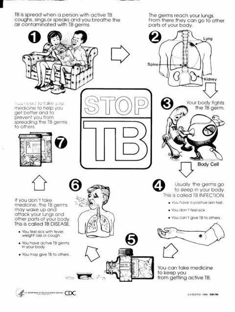 TB Test | Anderson County Health Department
